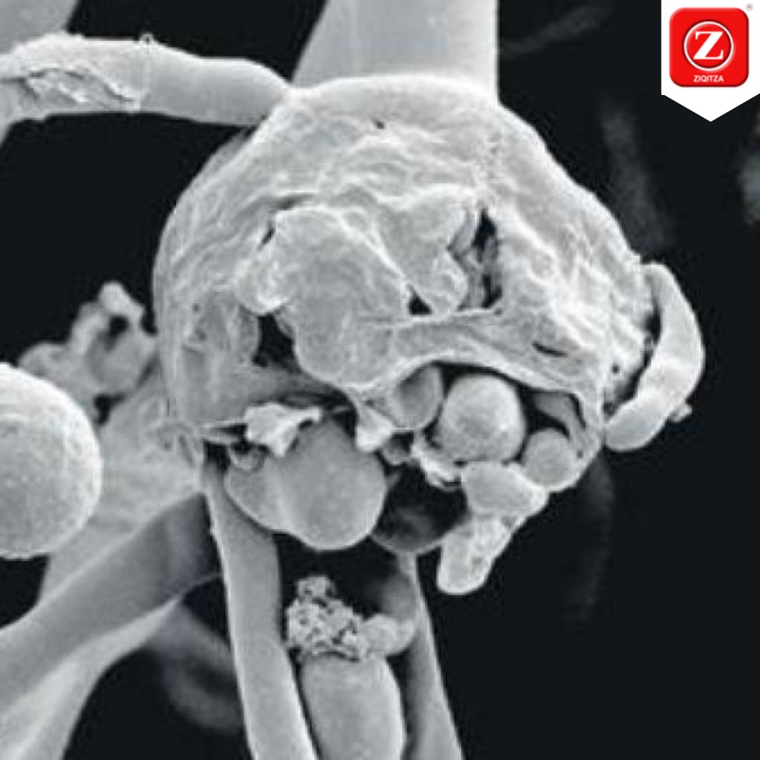 Everything you need to know about Black Fungus - Ziqitza HealthCare Ltd ...